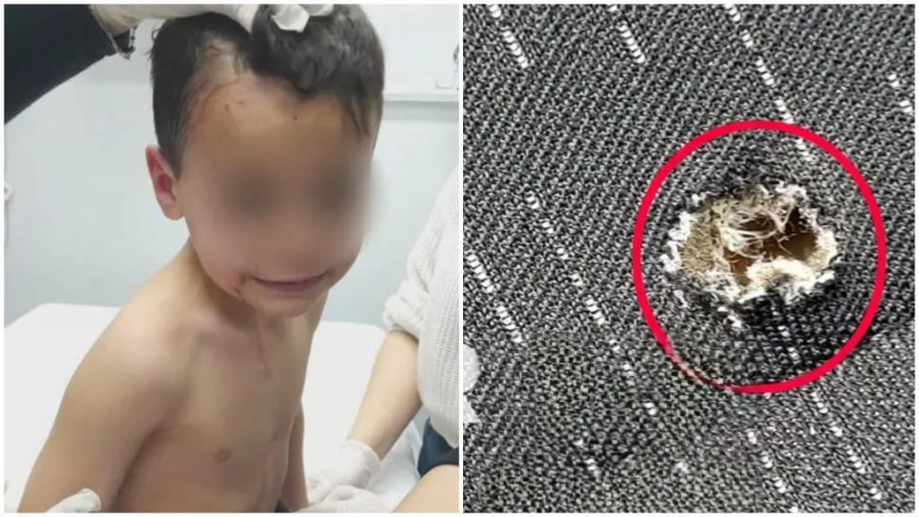 Un Hombre Le Disparó A Un Nene De 6 Años Tras Pelearse Con Su Papá En 4450